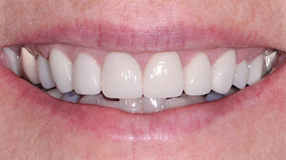 Smile Gallery | Dental Treatment Before and After Photos